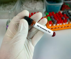 ¿Qué tipos de pruebas de VIH existen y cuáles recomiendan los médicos ...